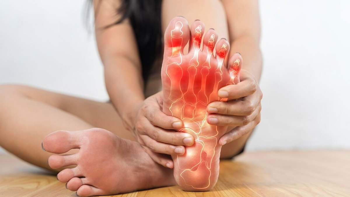 Gout Relief: 10 Natural Herbs to Lower Uric Acid Levels Fast